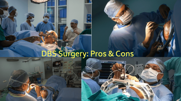 Deep Brain Stimulation Pros Cons