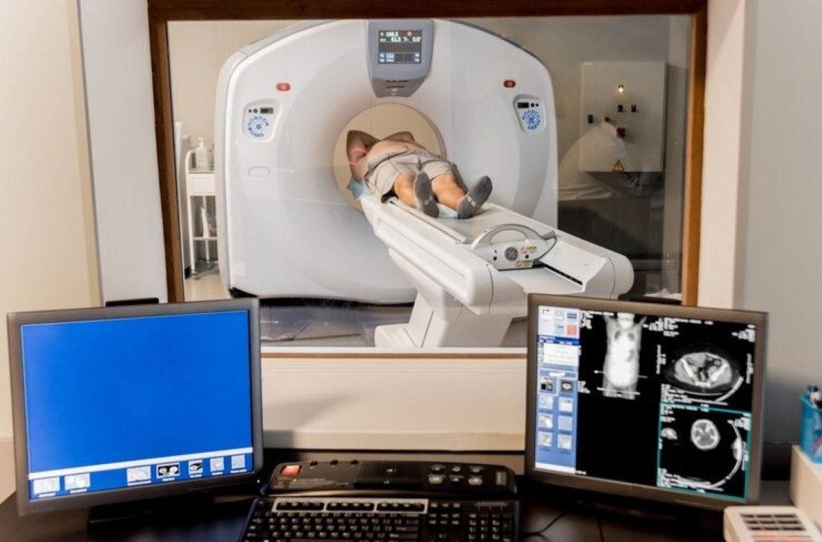 Magnetic Resonance guided Focused Ultrasound (MRgFUS)